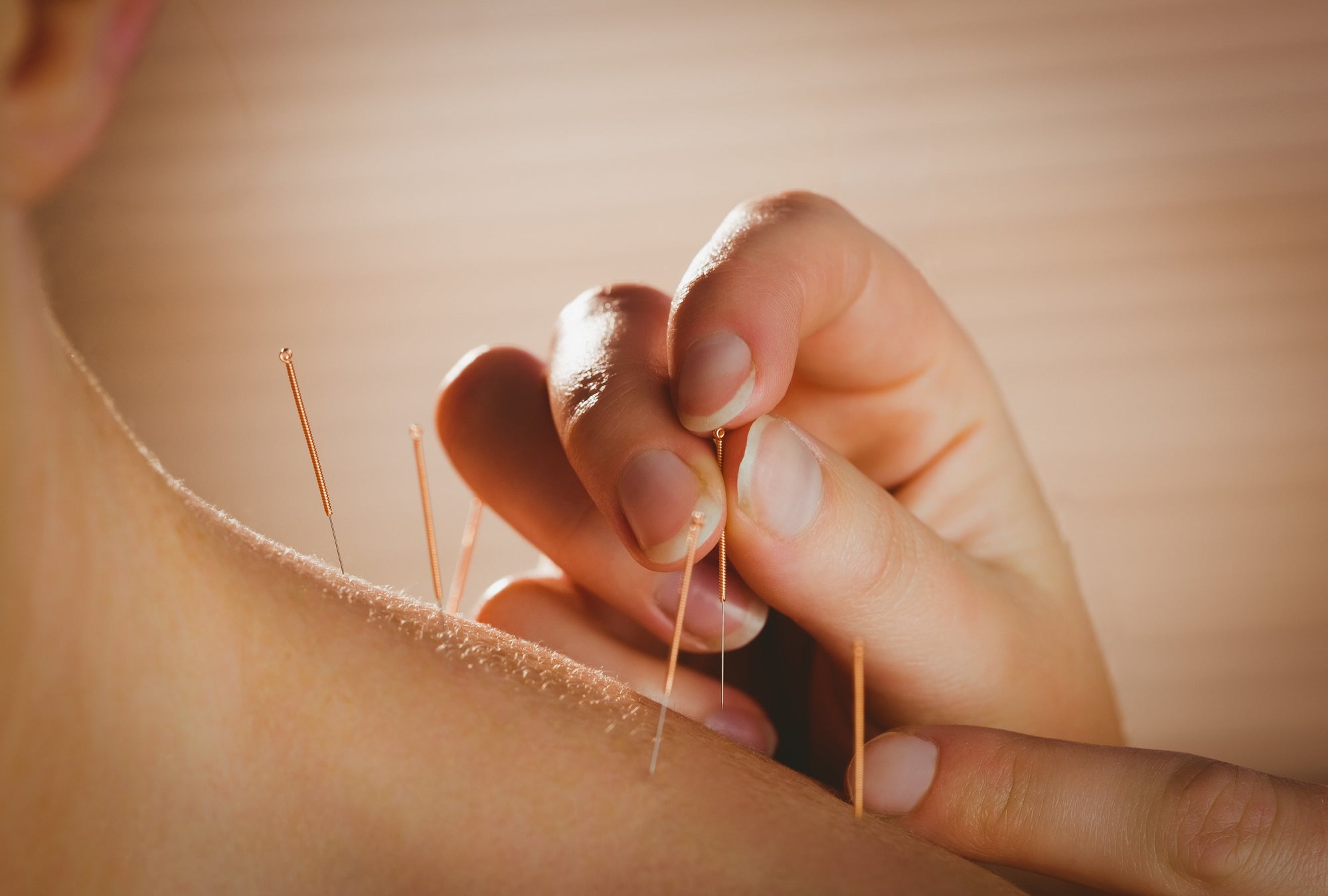 After Acupuncture: What You Should (and Shouldn’t) Do for Optimal Reco ...